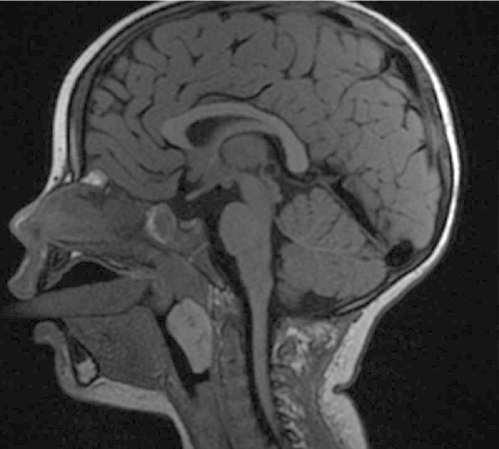 Continuum: Parada cardiorrespiratoria en niño de dos años